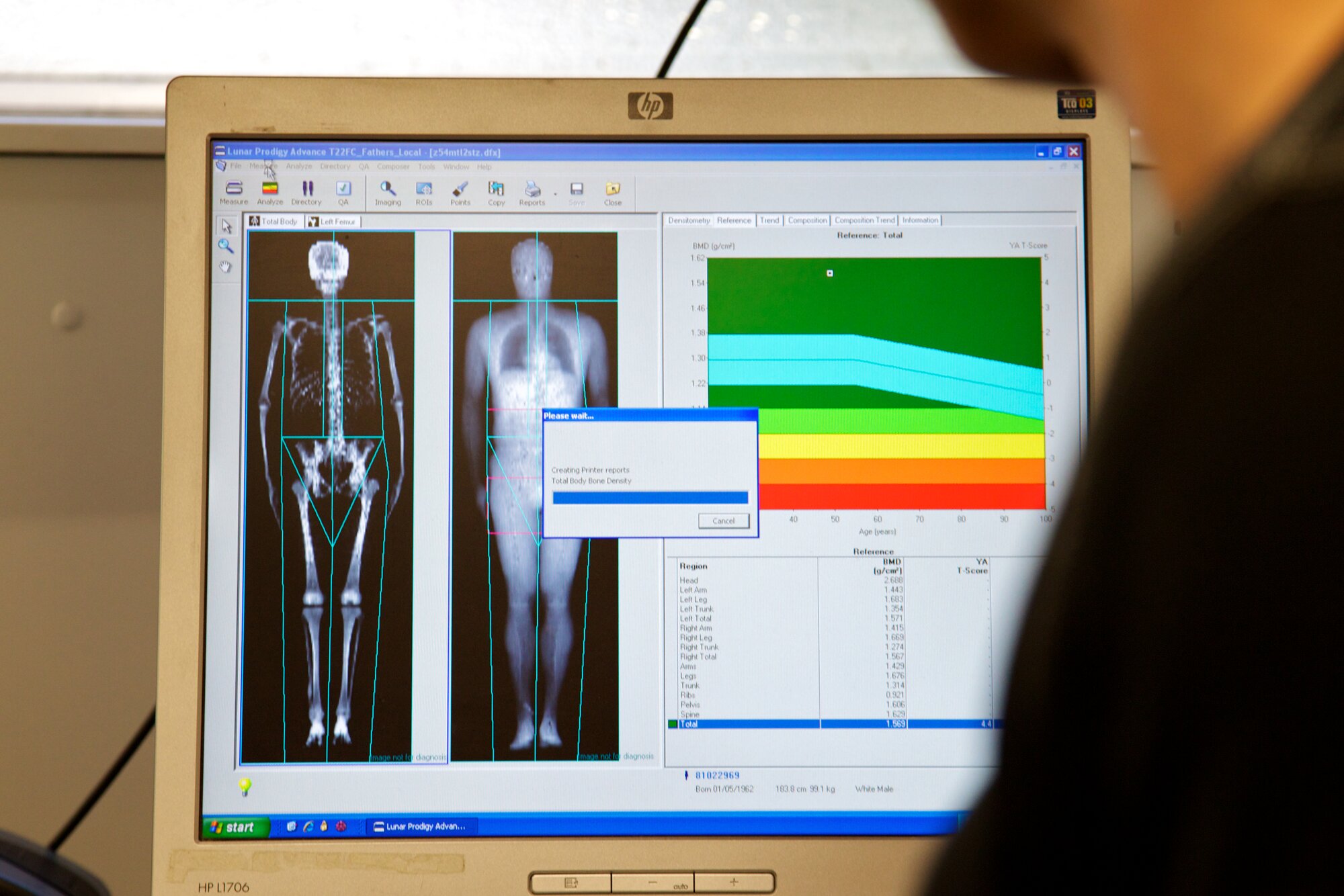Why Women Should Get a DEXA Scan Before 40 | Parsley Health