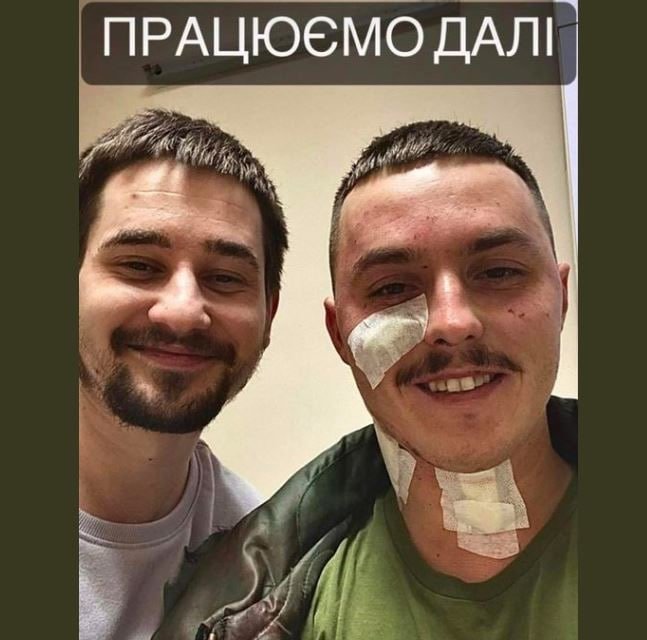 Ukrainian Pilot Snaps Bloody Parachute Selfie After Ejecting From MiG-29 Ukrainian Pilot Snaps Bloody Parachute Selfie After Ejecting From MiG-29