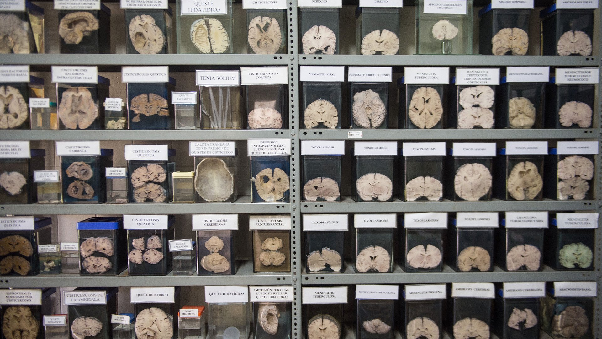 Pennsylvania Man Accused of Buying, Selling Human Skin and Organs ...