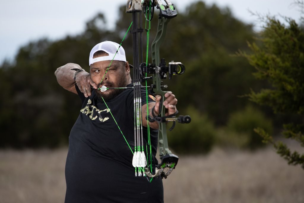 How Vets Pushed Prosthetics Industry To Make Better Products | Coffee ...