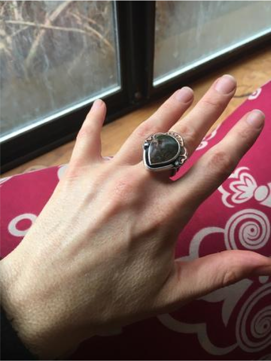 Sasha's Eczema Journey | Gladskin