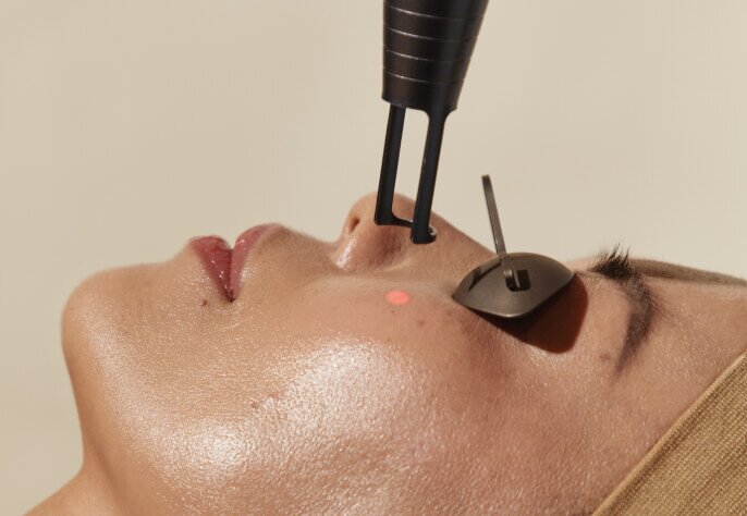 Treatments | Laser Facials & Resurfacing - Skin Laundry