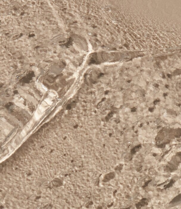 Laser Skin Resurfacing & Facial Rejuvenation - SKIN LAUNDRY