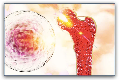 Bone-Dissolving Foods Seniors Must Avoid