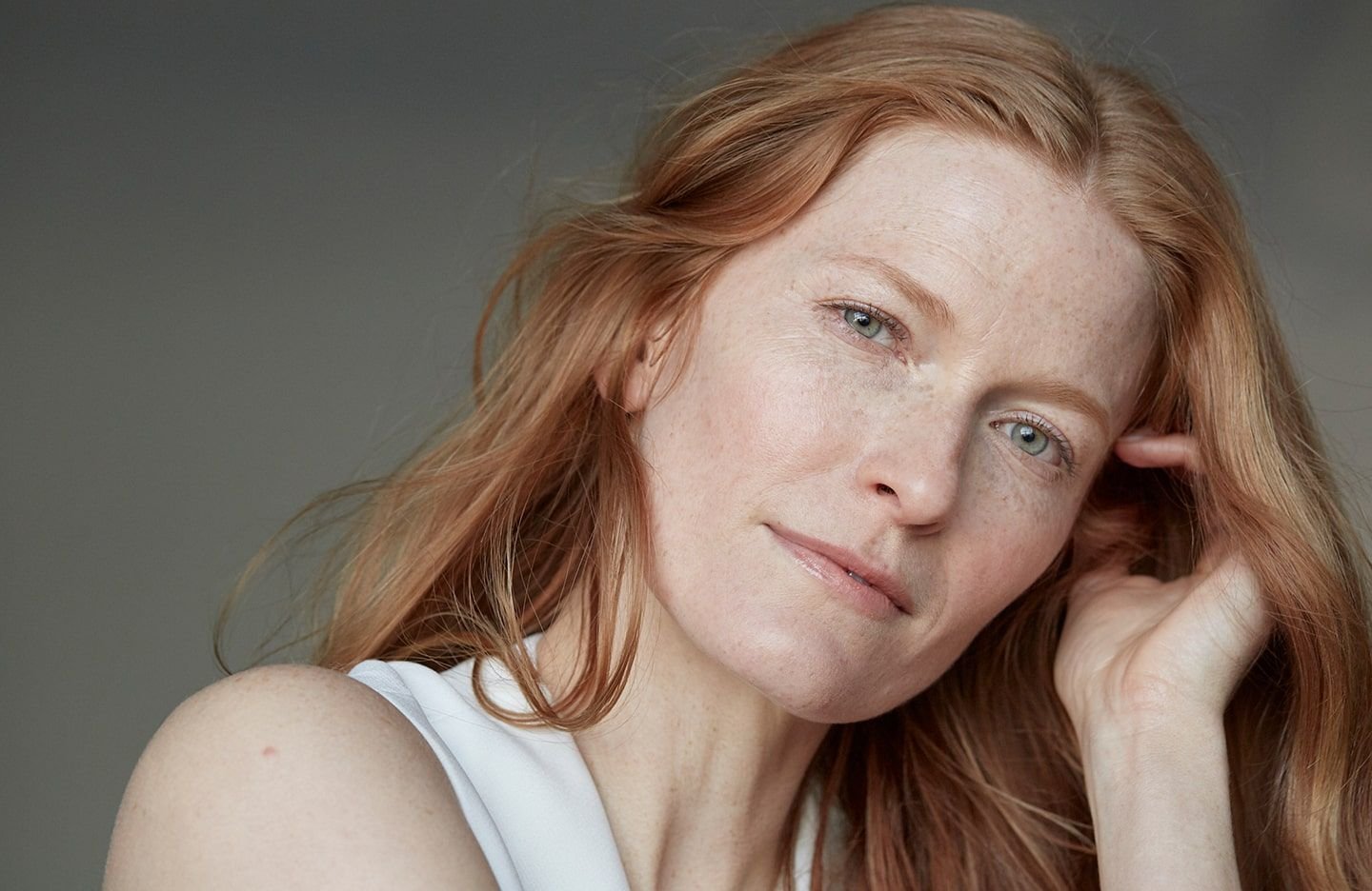 What is Post-Inflammatory Hyperpigmentation?