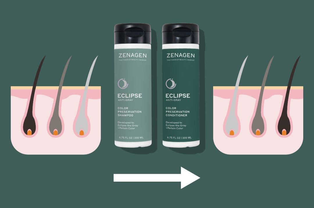 Eclipse Intro – Zenagen
