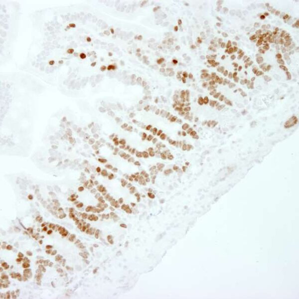Ki-67: A Nuclear Antigen Uniquely Qualified as a Marker of Cellular ...