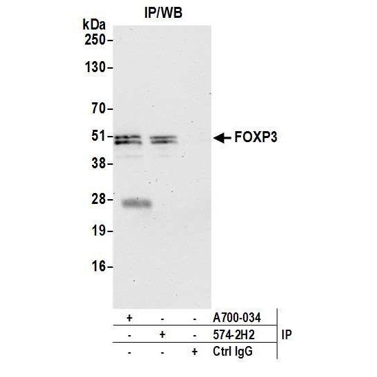 FOXP3 Regulatory T Cell Function | Fortis Life Sciences