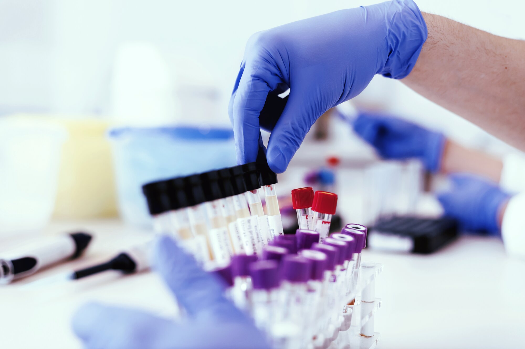 Diagnostic Components | Fortis Life Sciencess