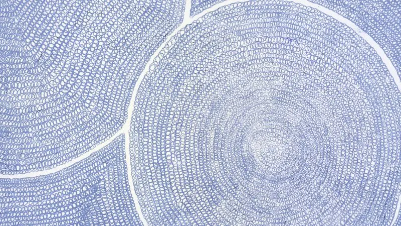 WHO-5 wellbeing assessment | Headway