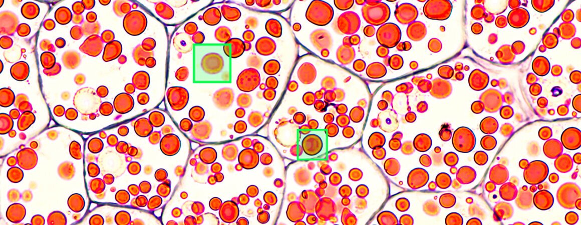 Cell detection - a computer vision project.