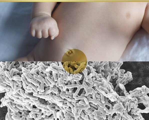 Evivo Probiotic for Baby Starter Kit - 28 Packets (0-6 Months ...